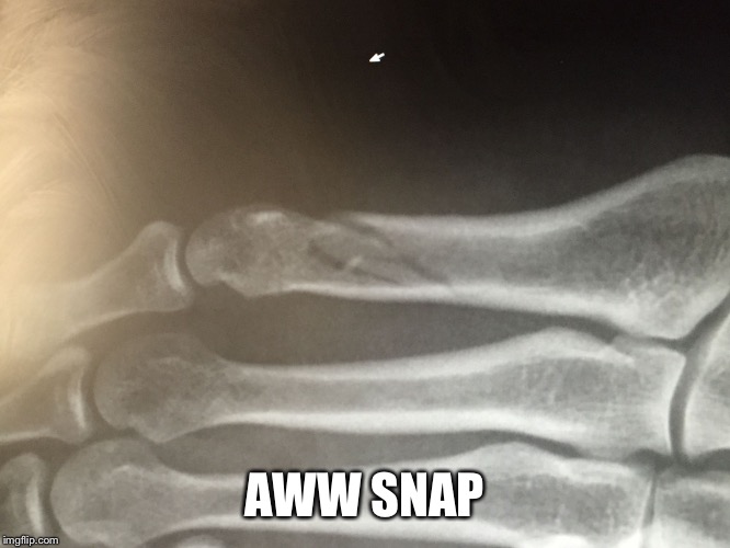 Image tagged in aww snap - Imgflip