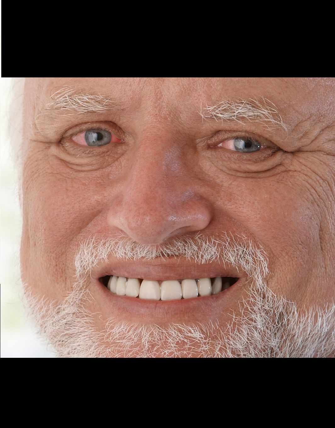 Hide The Pain Harold Blank Template Imgflip