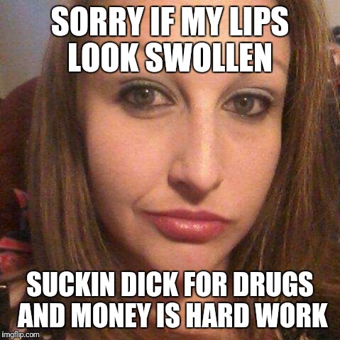 Swollen Lip Memes