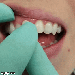 making tooth - Imgflip