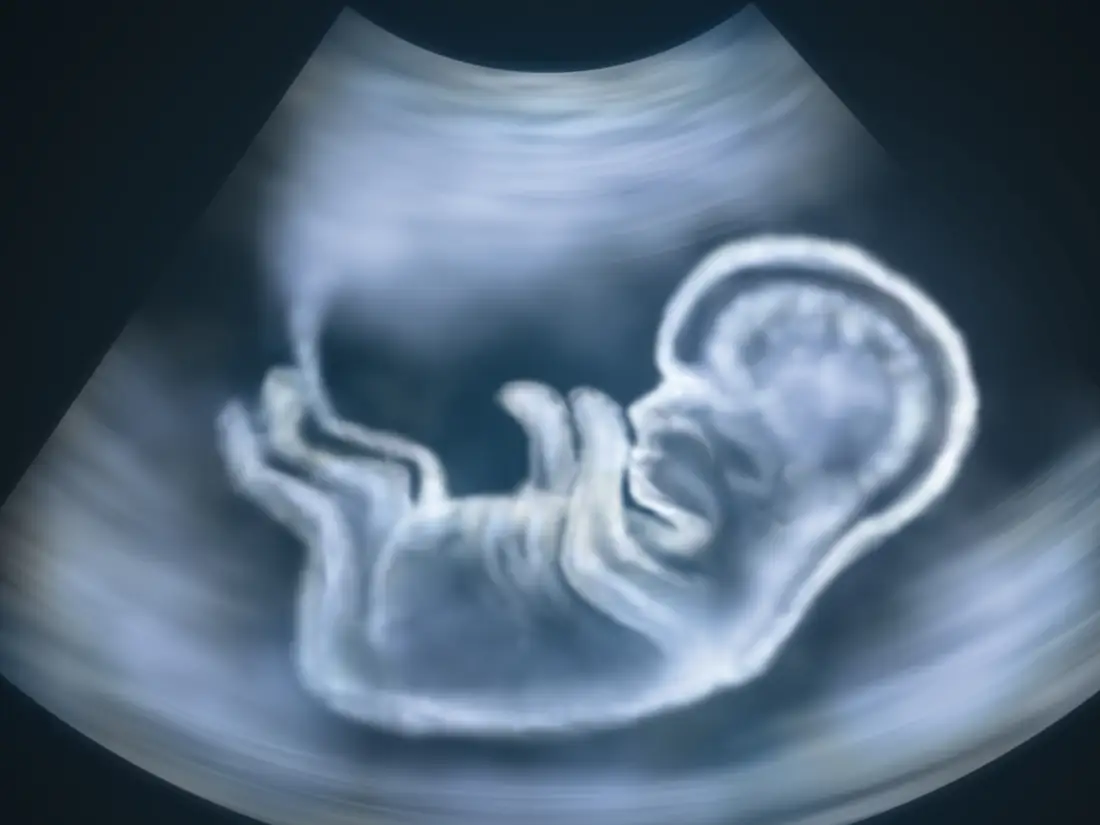Ultrasound Blank Template Imgflip