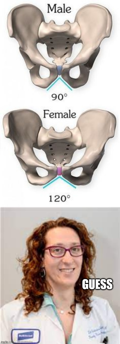 Image tagged in xx xy - Imgflip