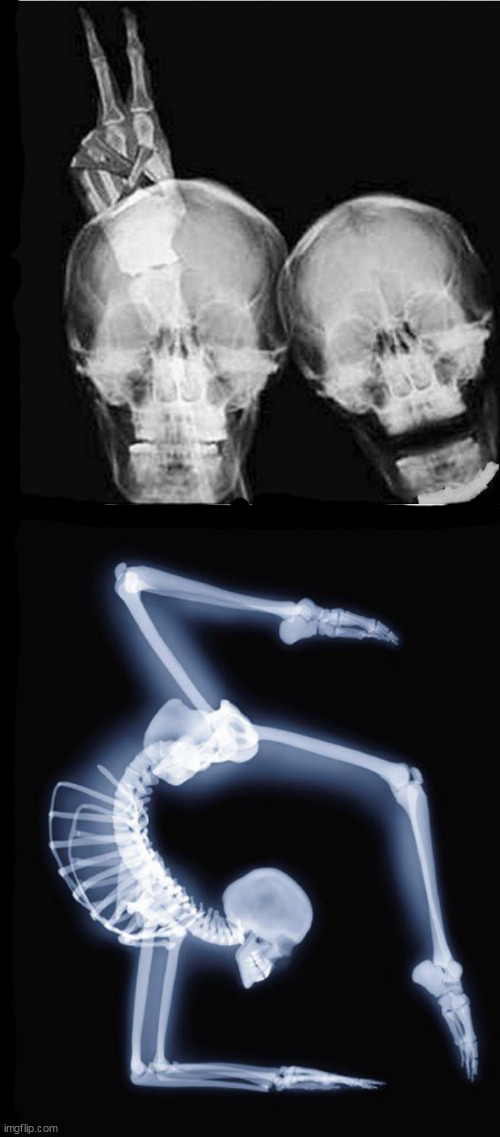 Image tagged in bones - Imgflip