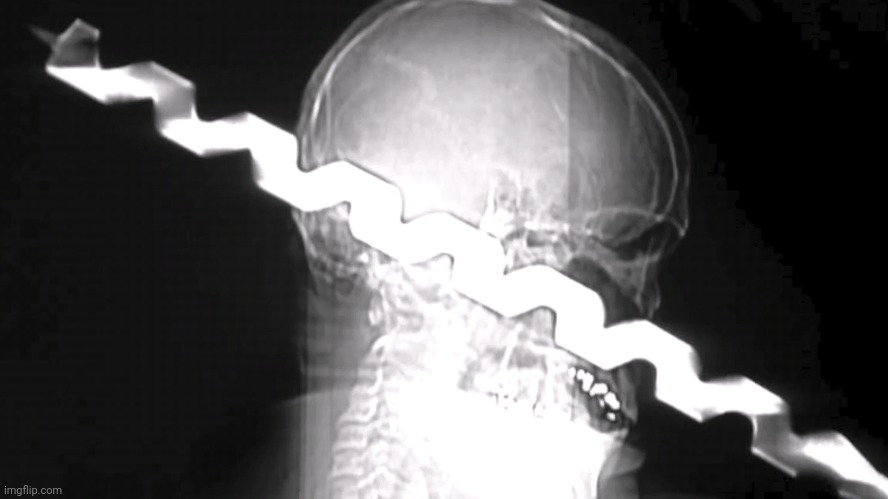 Mind Noodle Extractor - Imgflip