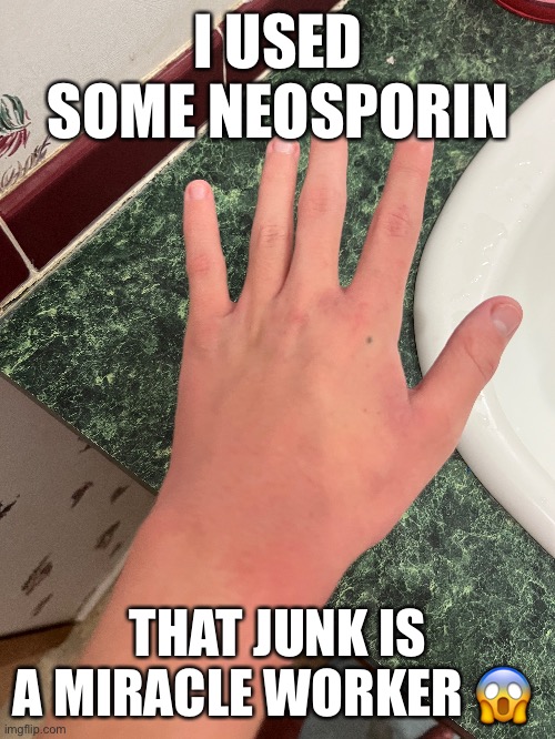 Imd, it looked a lot worse than it actually was - Imgflip