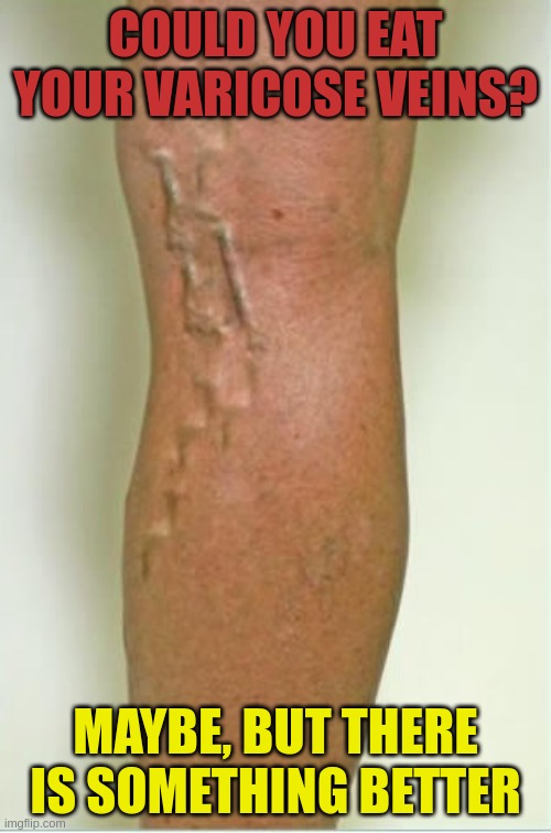 varicose - Imgflip