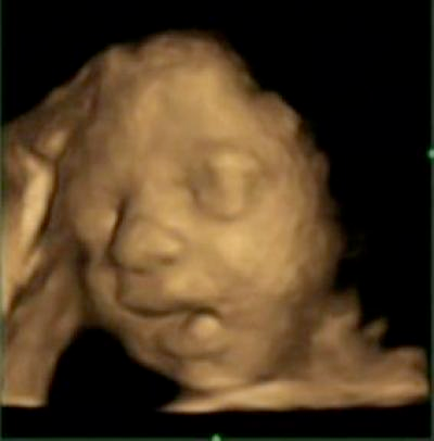 fetus rizz Blank Template - Imgflip