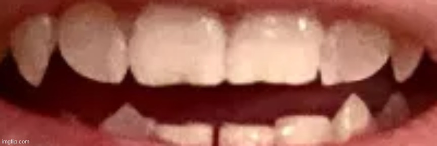 Do you guys think my teeth look...unusually sharp...? - Imgflip