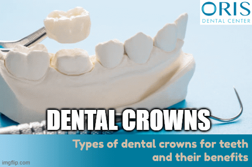 Dental Crowns - Imgflip