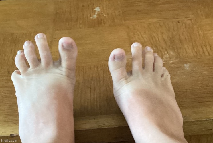 IcyXD FEET!!! v4 Blank Template - Imgflip
