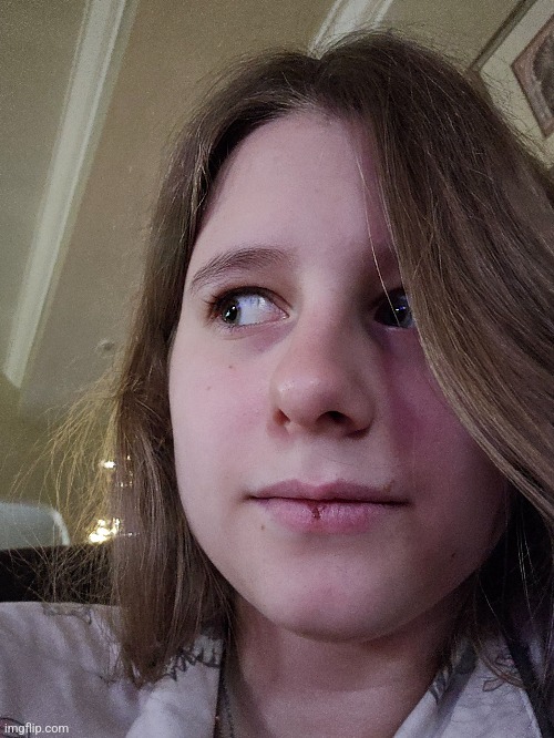 Got a split lip and blood around my mouth :sob: - Imgflip