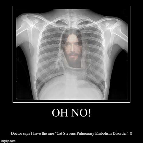 Pulmonary Embolism Memes Day In The Life Of A DOCTOR: Radiologist