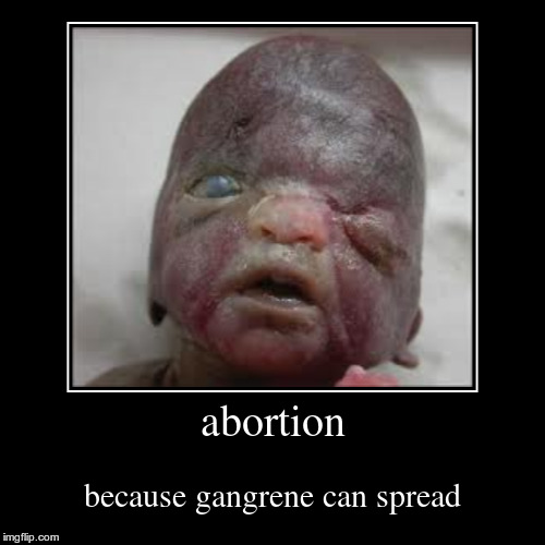 abortion - Imgflip